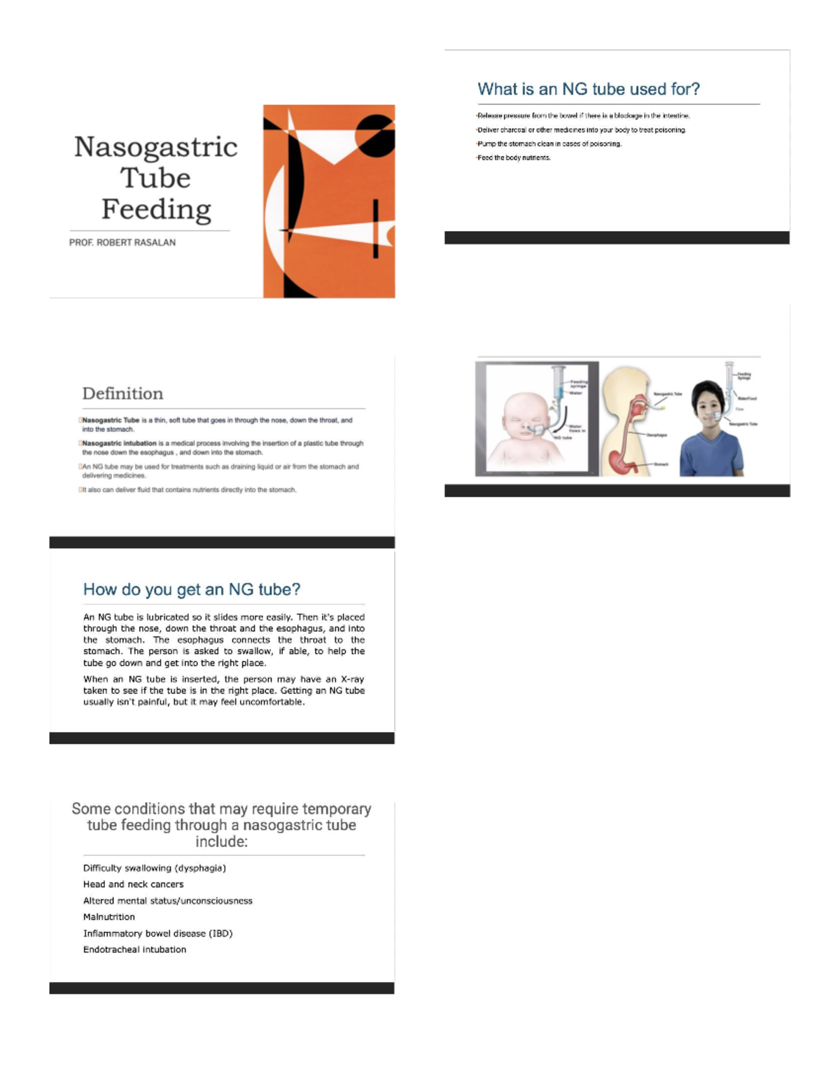 NGT - Uses and Procedures for Nasogastric Tube Feeding - Studocu