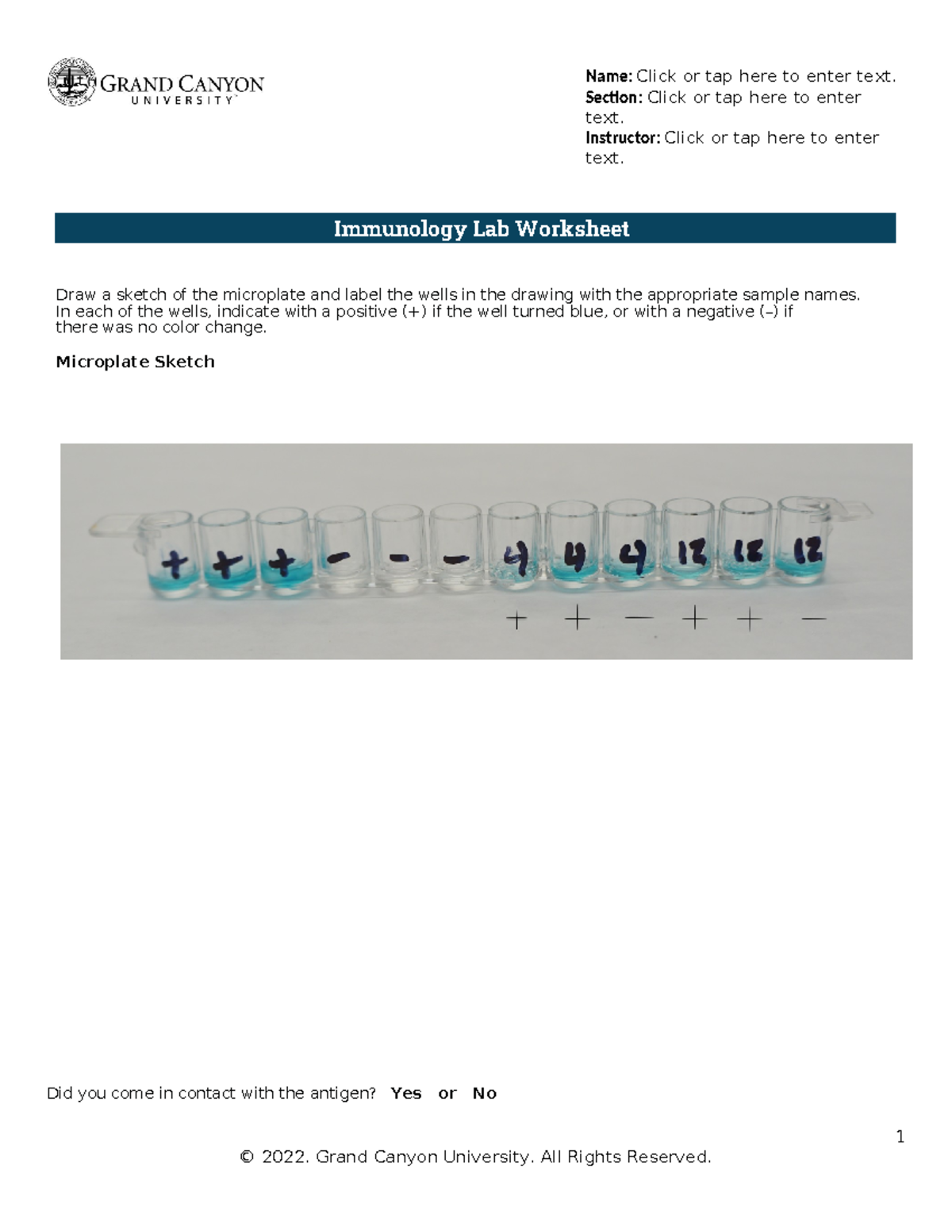 Immunology Lab Worksheet - Lab8 WS - Studocu
