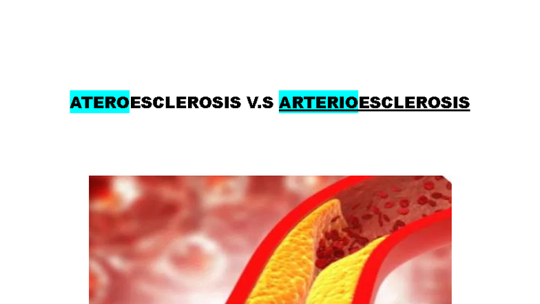 Aterosclerosis vs Arteriosclerosis: Definición y Clasificación - Studocu