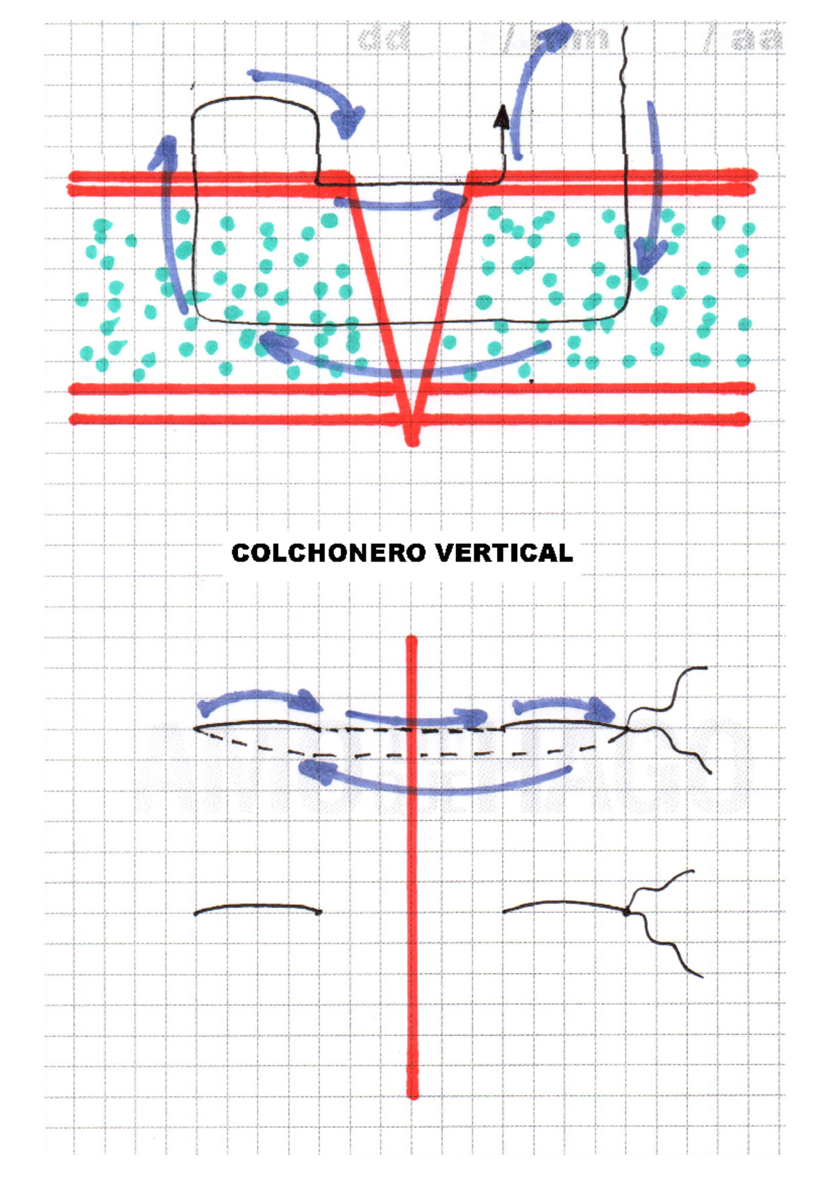 4 Colchonero vertical - Apuntes - Medicina Interna - dd aa COLCHONERO ...