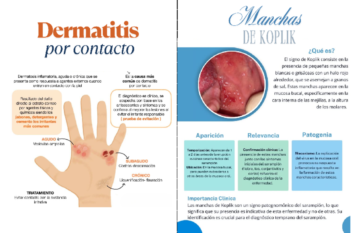 dermatitis y sarampeon - Manchas Dermatitis DE KOPLIK por contacto es ...