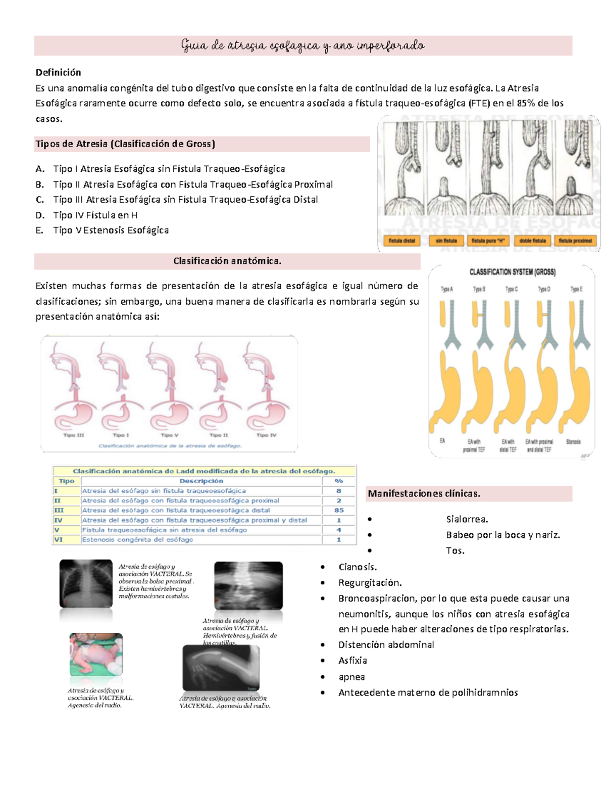 Atresia esofágica y ano imperforado - Definición Es una anomalía ...