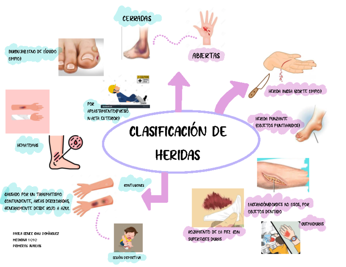 Clasificación. de heridas - Clasificación de heridas Abiertas Cerradas Herida incisa (corte ...