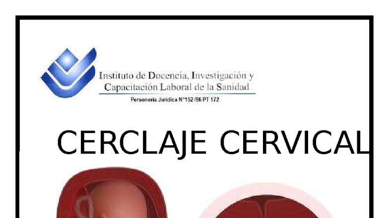 Cerclaje Cervical: Causas, Tipos y Recomendaciones - Evaluativo 3164 ...