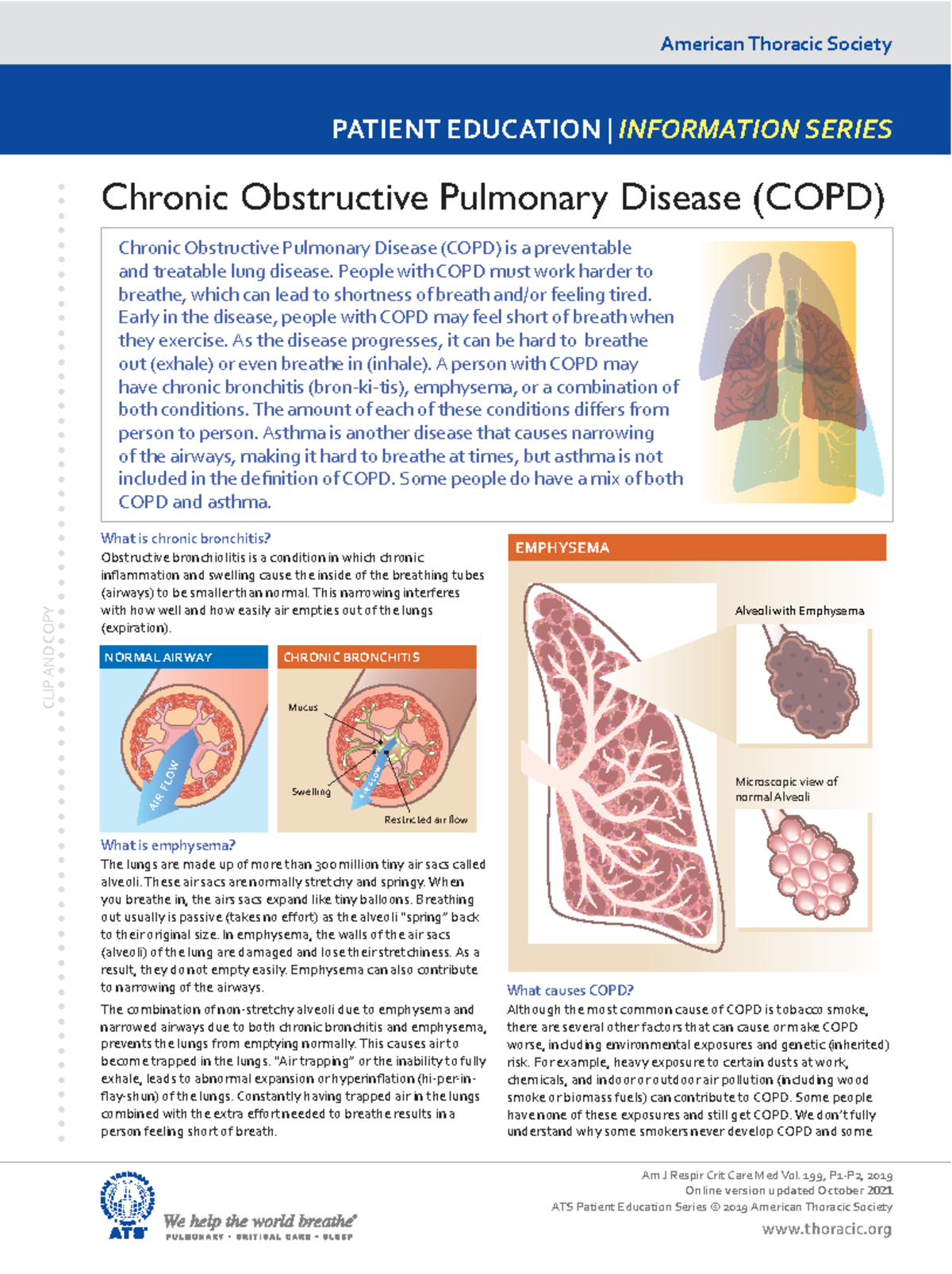 COPD-Intro: Understanding Chronic Obstructive Pulmonary Disease - Studocu