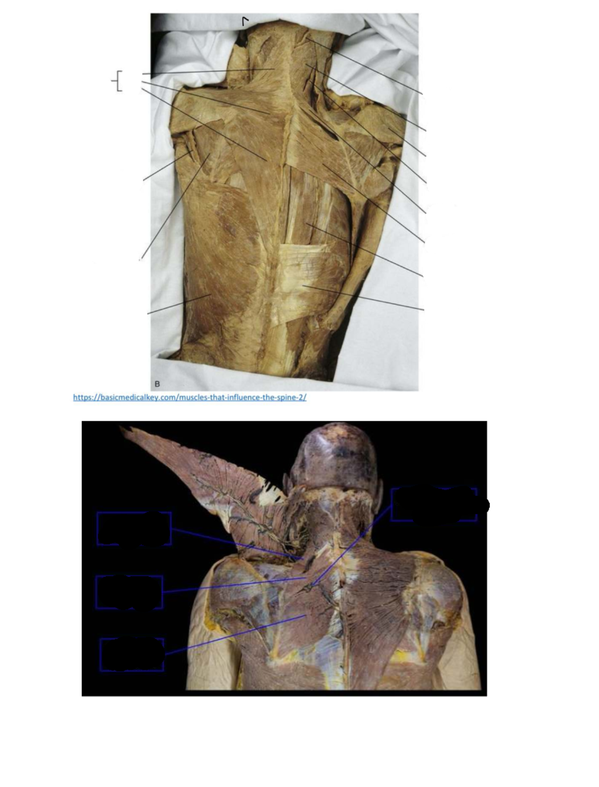 Back muscles empty - Anatomy - ANAT 171 - 'T' B - Studocu