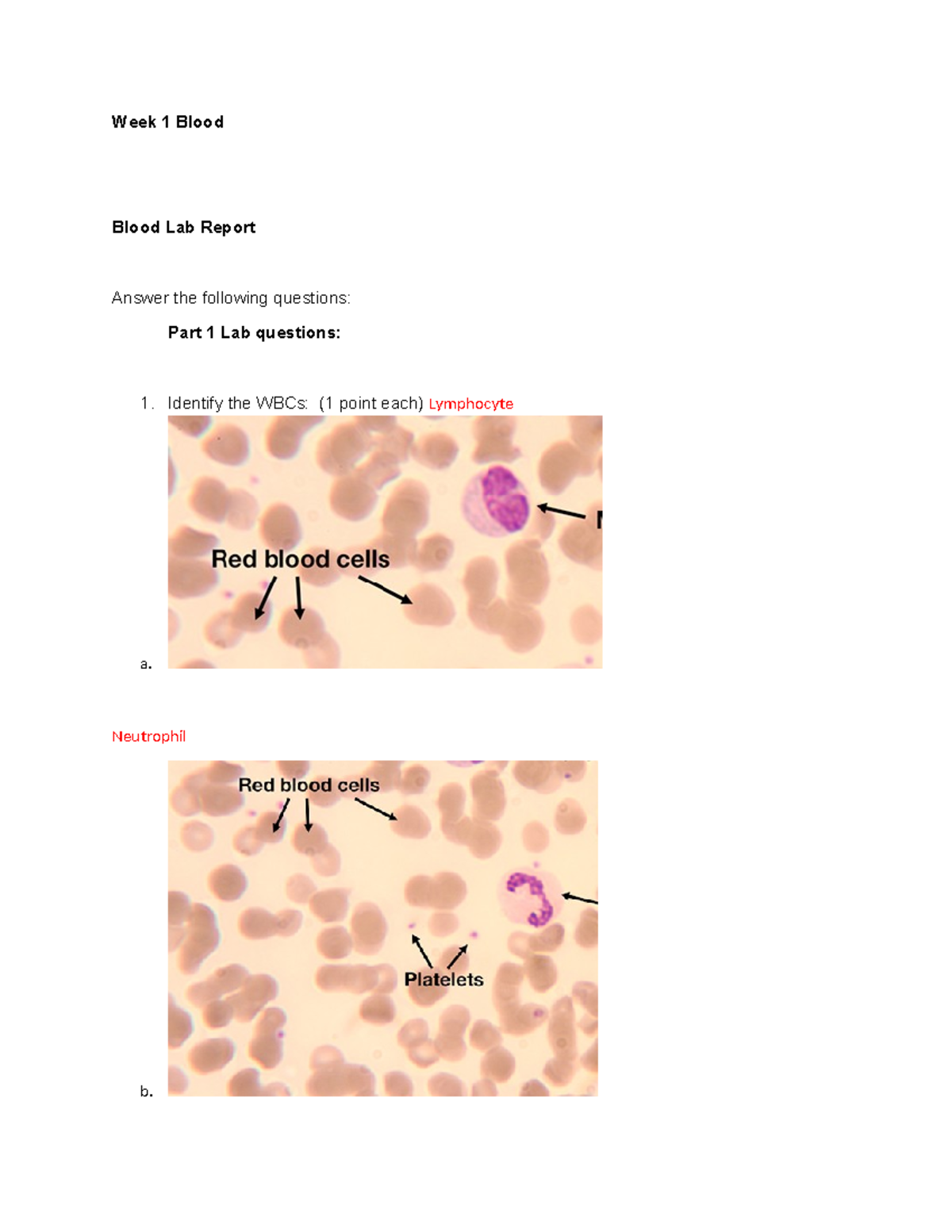 A&P3 Week 1 Blood Lab Report and Analysis - Studocu