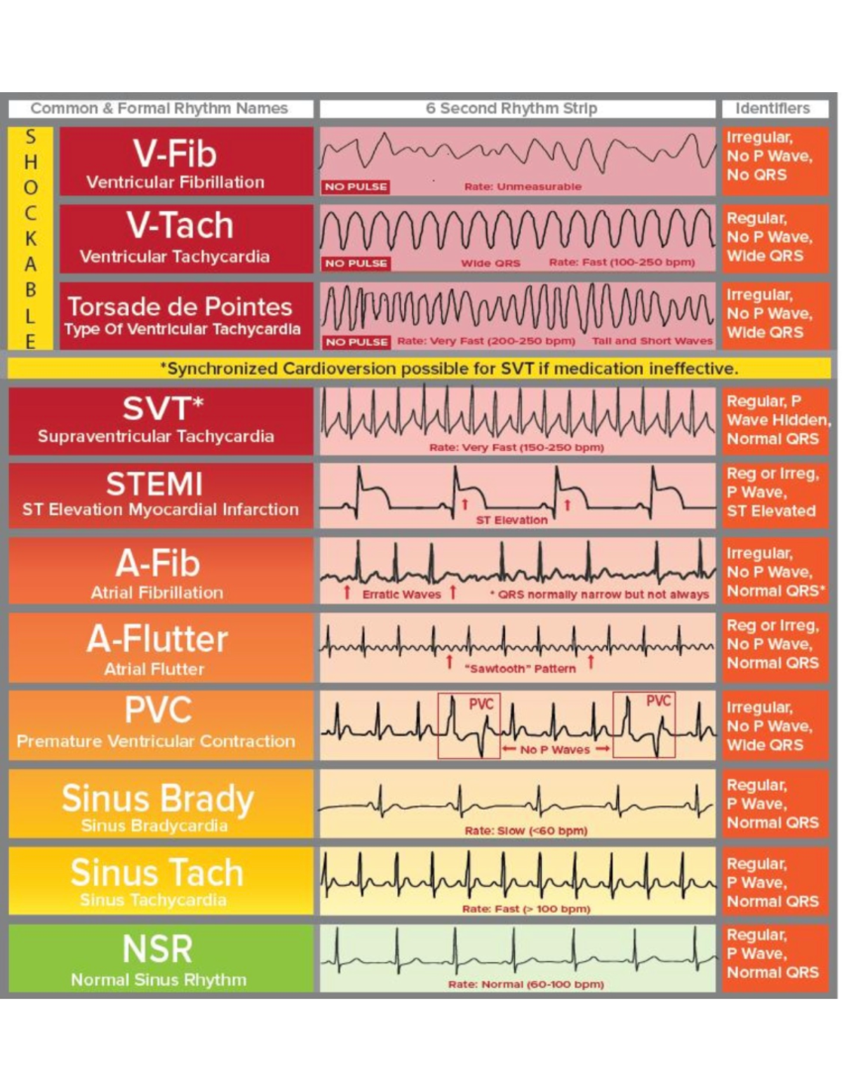 Cardiac rhythms - NURS 420 - Studocu