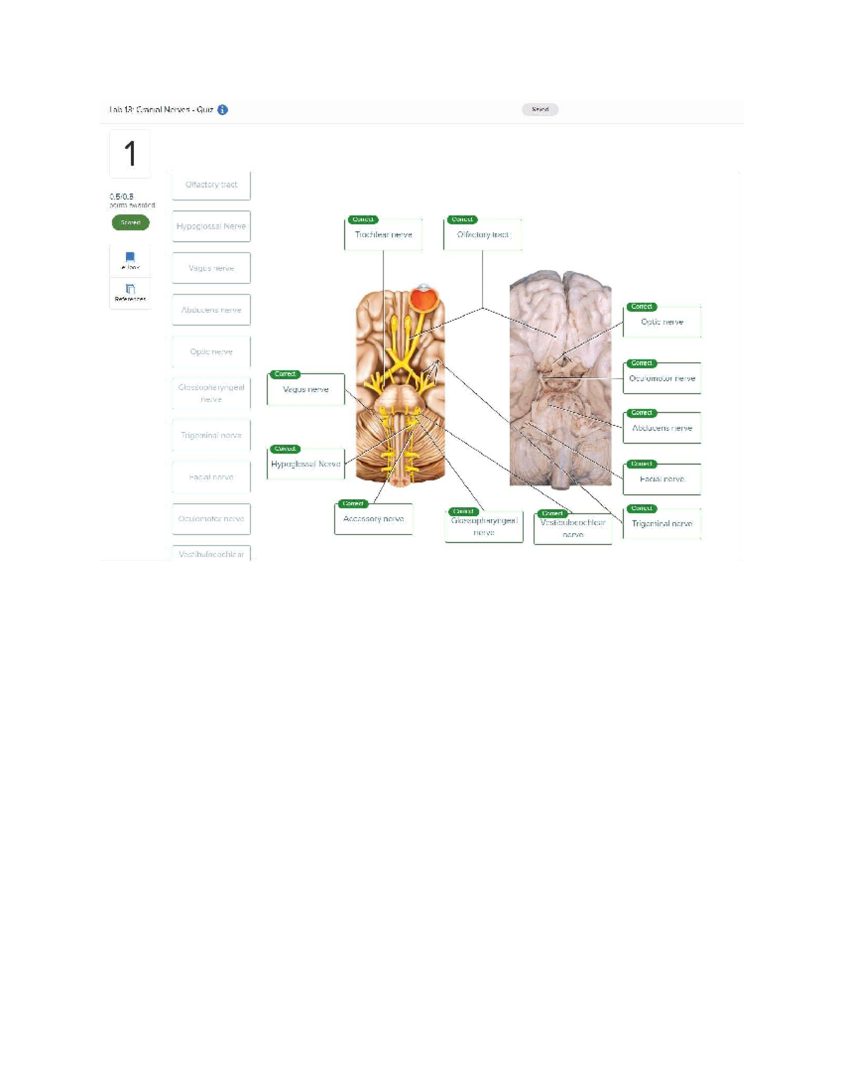 BIO 201 Lab 13: Cranial Nerves Quiz and Functions - Studocu