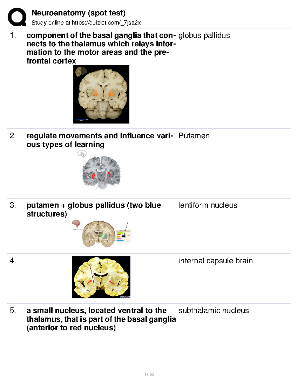Neuroanatomy Flashcards: Key Terms & Structures of the Brain - Studocu