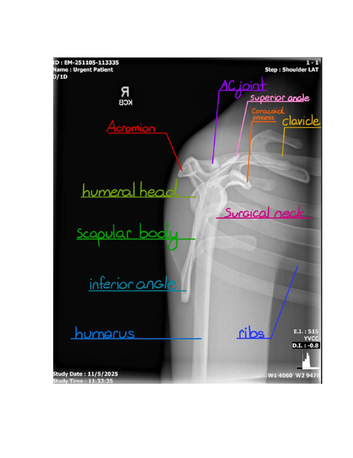 Phantom Assignment Criteria - Lateral Shoulder Projection Analysis ...