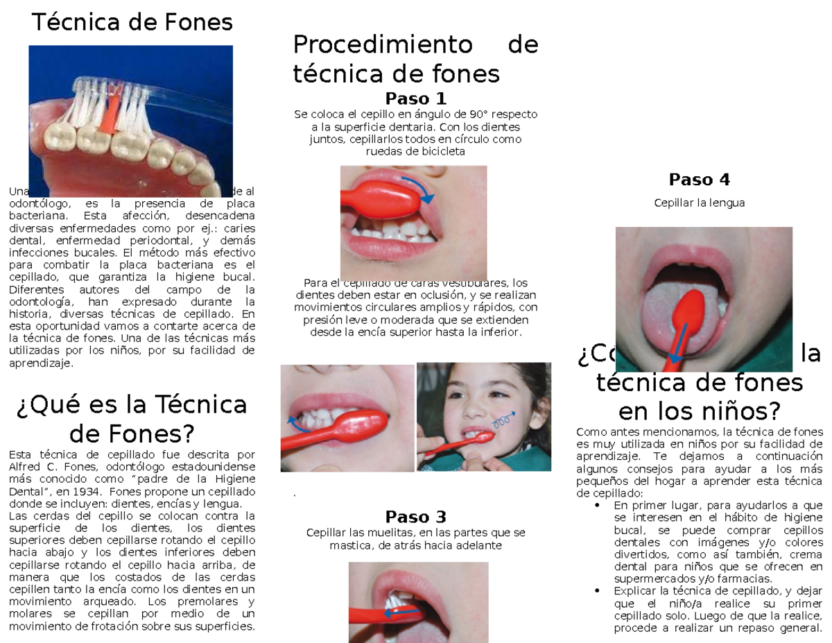 Técnica de Fones: Método de Cepillado para Niños en Odontología - Studocu