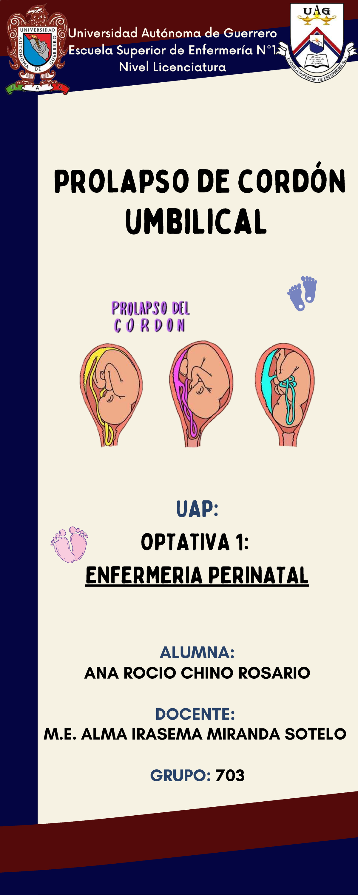 Prolapso del Cordón Umbilical: Emergencia Obstétrica en Enfermería ...