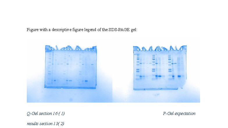 Lab Report 9: Gel Analysis of LDH Purification via Affinity ...