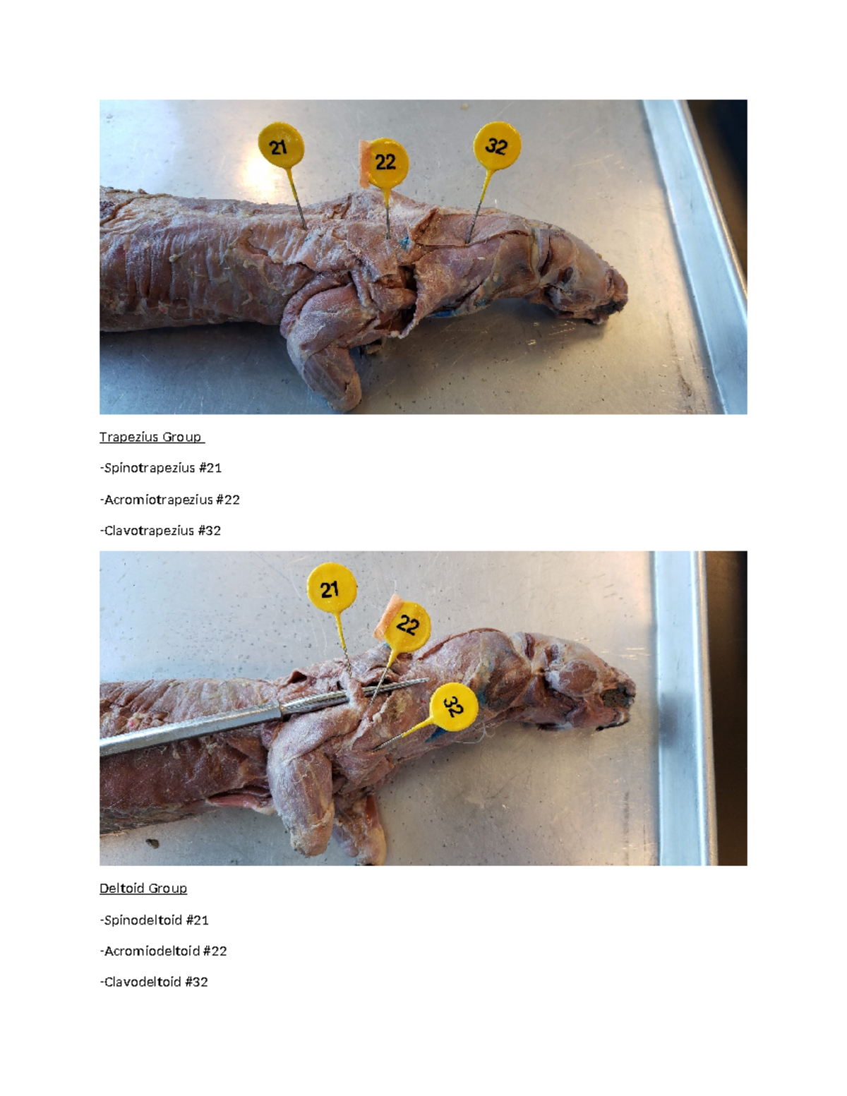 Master Mink Dissection Photo Altas 2022 - Trapezius Group ...