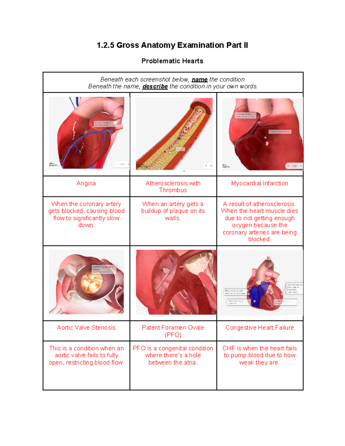 1.2.5 Gross Anatomy Exam Part II: Heart Conditions & Descriptions - Studocu