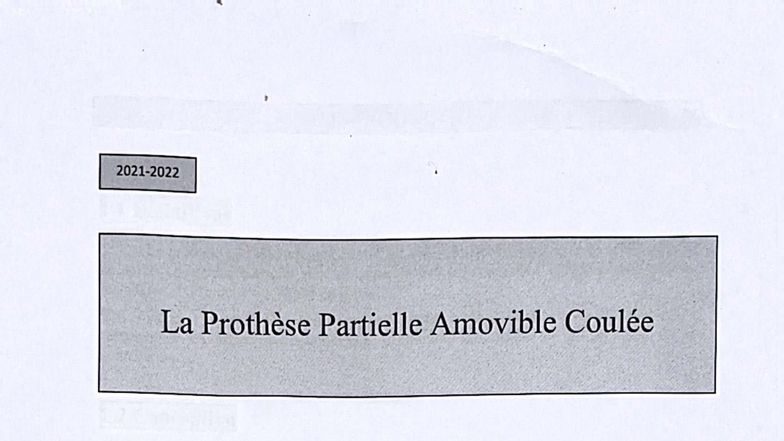 La Prothèse Partielle Amovible Coulée - DETHIER Joy IFAPME 1 ...