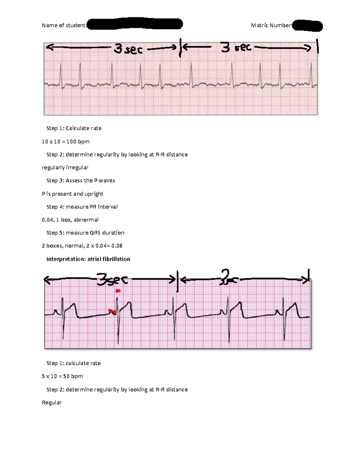 PRE TEST ECG W (210244) - Answers & Interpretations of 6 ECG Questions ...