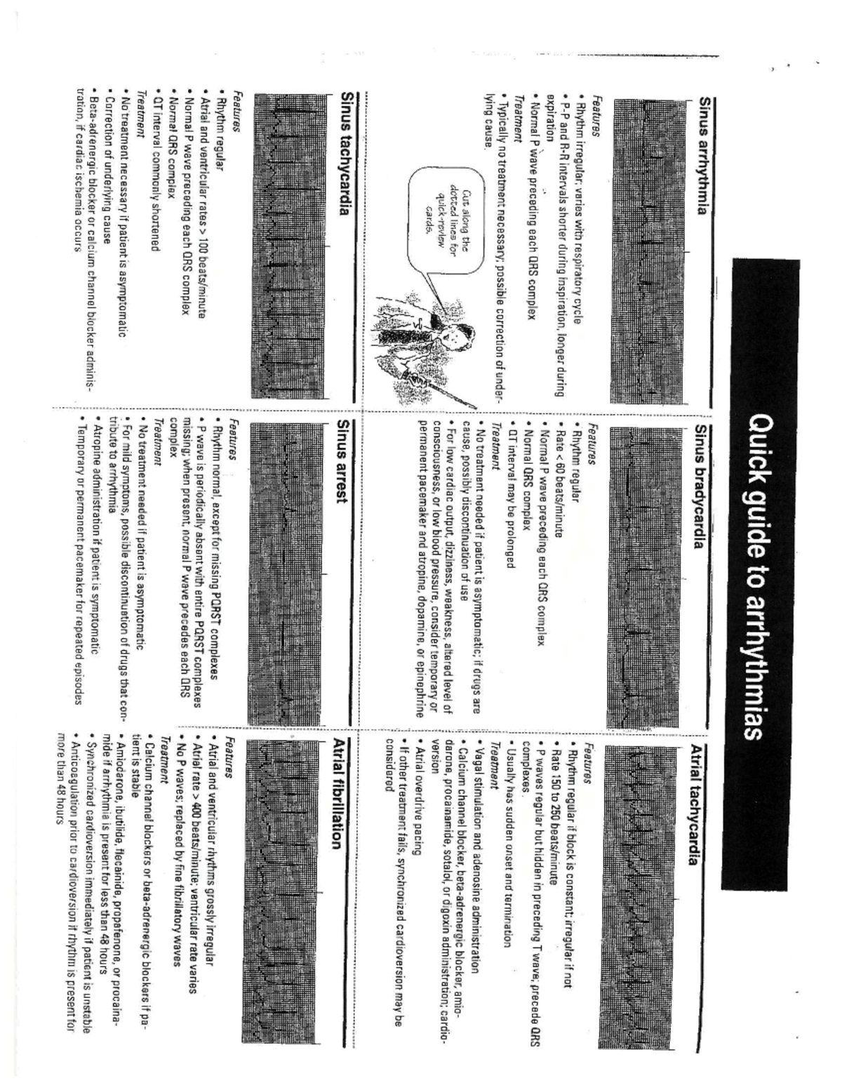 ECG Quick Guide to Arrhythmias: Key Features & Treatments - Studocu