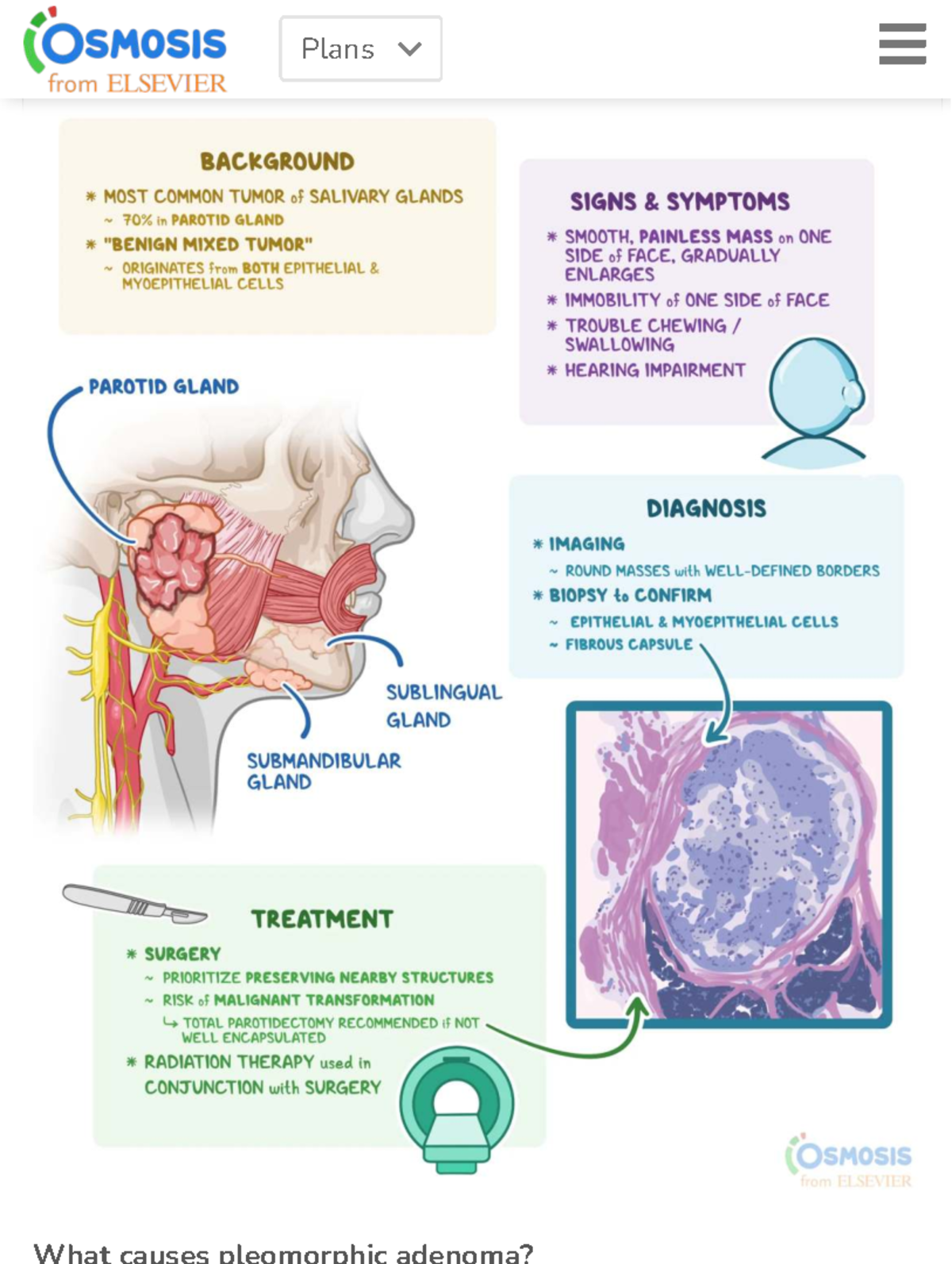 OSM 101: Pleomorphic Adenoma - Causes, Signs & Symptoms Overview - Studocu