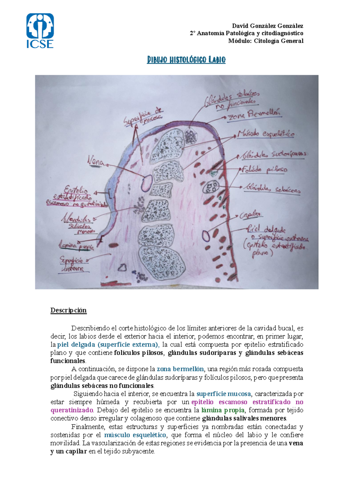 Dibujo Histológico del Labio - 2º Anatomía Patológica y Citodiagnóstico ...