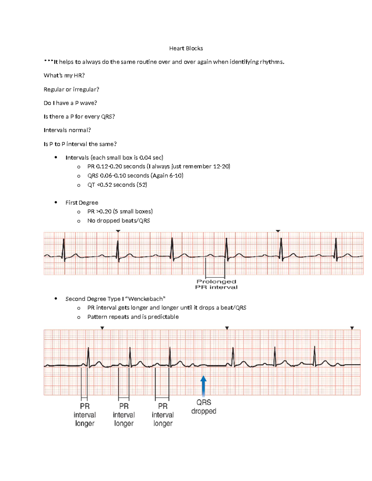 Cardiac Heart Blocks Cheat Sheet: Key Rhythm Identification Tips - Studocu