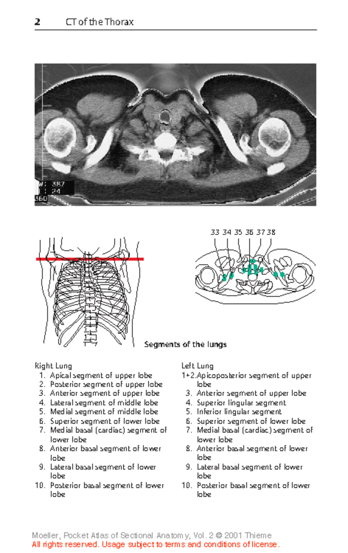 CT of the Thorax: Lung Segments Overview and Anatomy Notes - Studocu