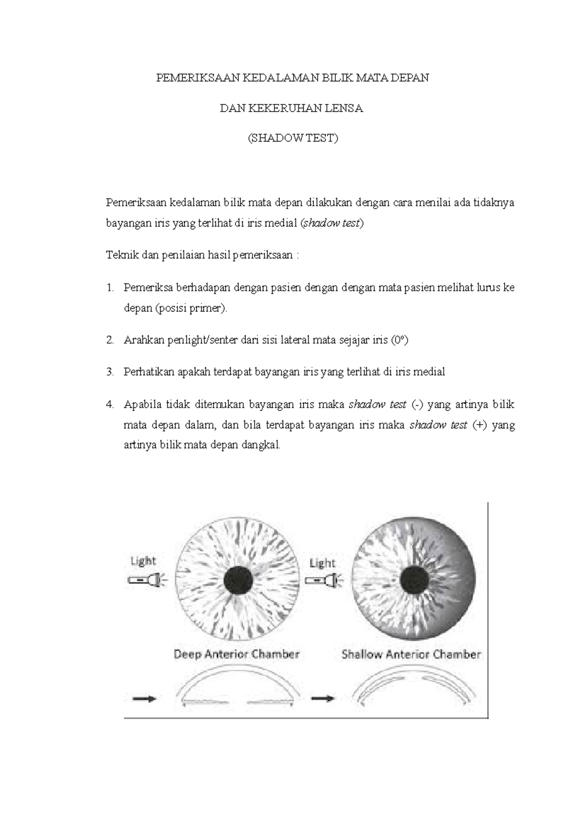 5. Pemeriksaan Kedalaman Bilik MATA Depan dan Kekeruhan Lensa (SHADOW ...