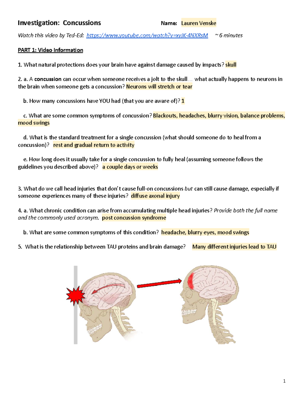 Investigation: Concussions and Brain Damage - Insights and Findings ...