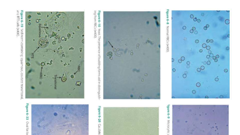 AUBF Microscopic Analysis of Normal Acid and Alkaline Crystals - Studocu