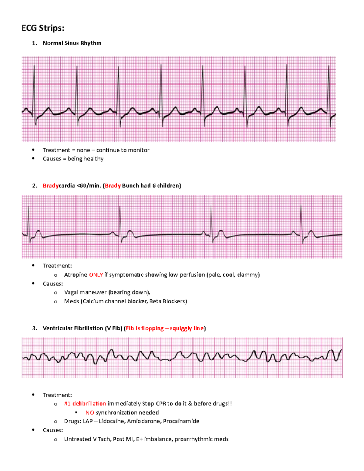 Advanced nursing Exam 2 Simple Nursing - ECG Strips: Normal Sinus Rhythm Treatment = none ...