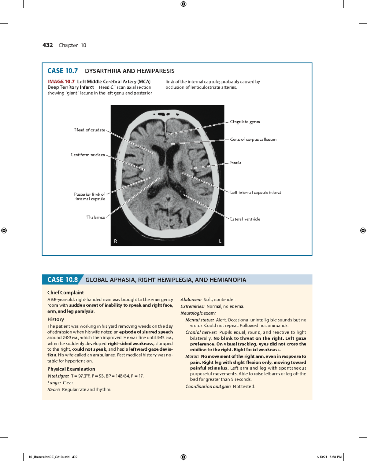 432 Chapter 10 Case Study: Dysarthria, Hemiparesis & MCA Infarct - Studocu
