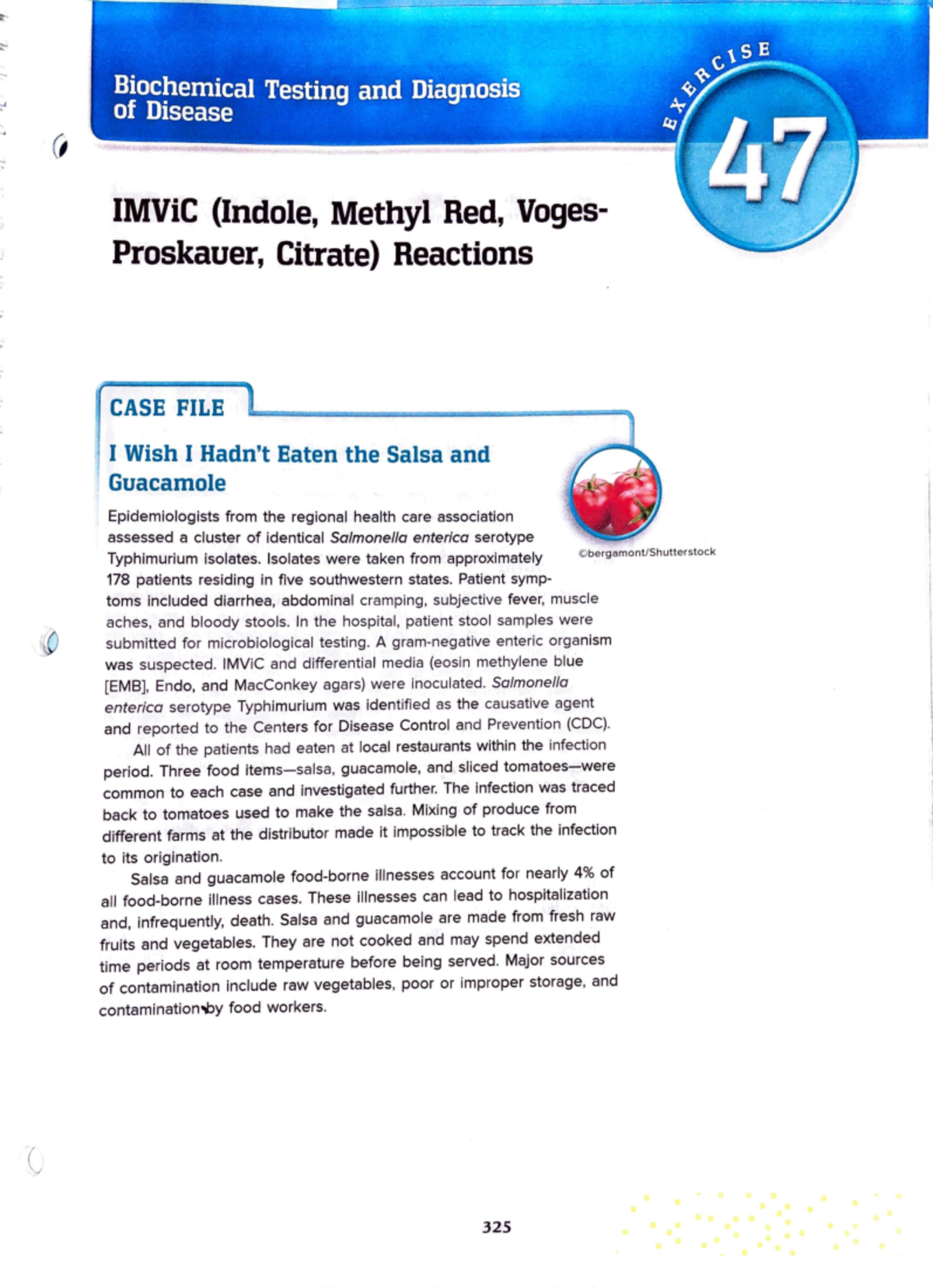 IMViC Biochemical Tests: Diagnosing Salmonella Enterica Cases (Lab 47 ...