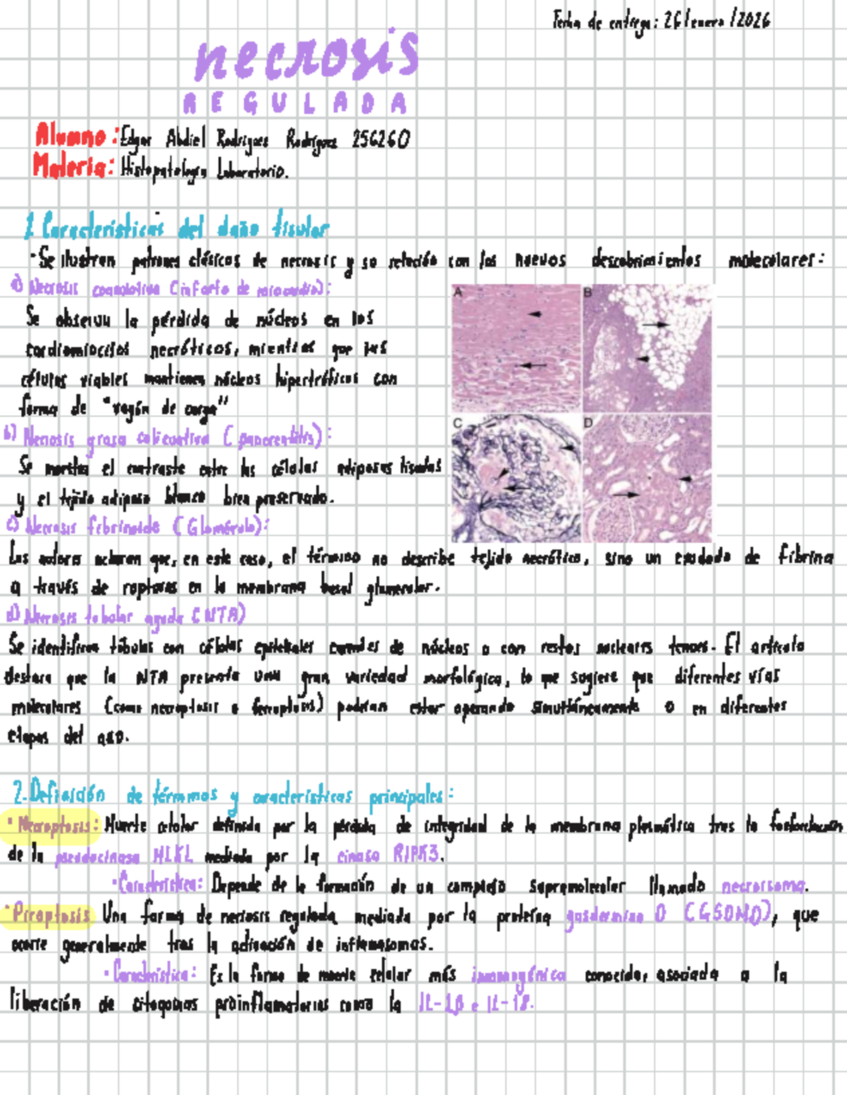 Necrosis Regulada: Apuntes Interesantes en Histopatología - Studocu