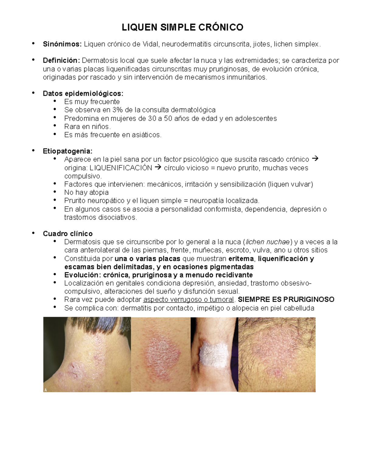 Resumen sobre Liquen Simple Crónico: Definición y Tratamiento - Studocu