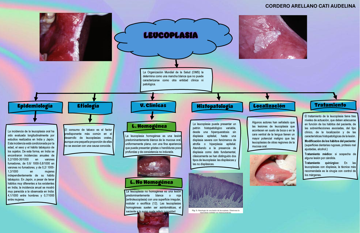 Mapa de Leucoplasia: Análisis Epidemiológico y Tratamiento - Studocu