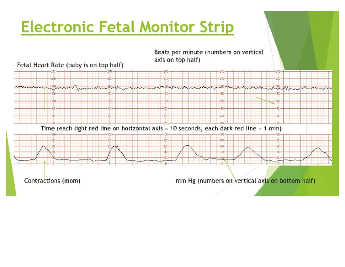 Fetal Heart Rate Patterns: VEAL CHOP & EFHM Analysis - Studocu