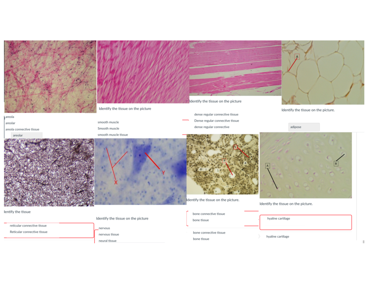 Connective Tissue Identification: Types & Images Analysis - Studocu