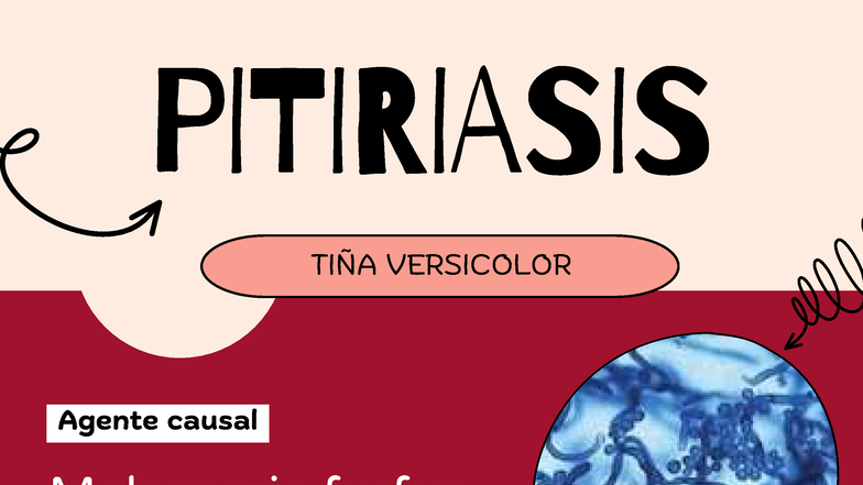 Infografía sobre Pitiriasis Tiña Versicolor y su Tratamiento - Studocu