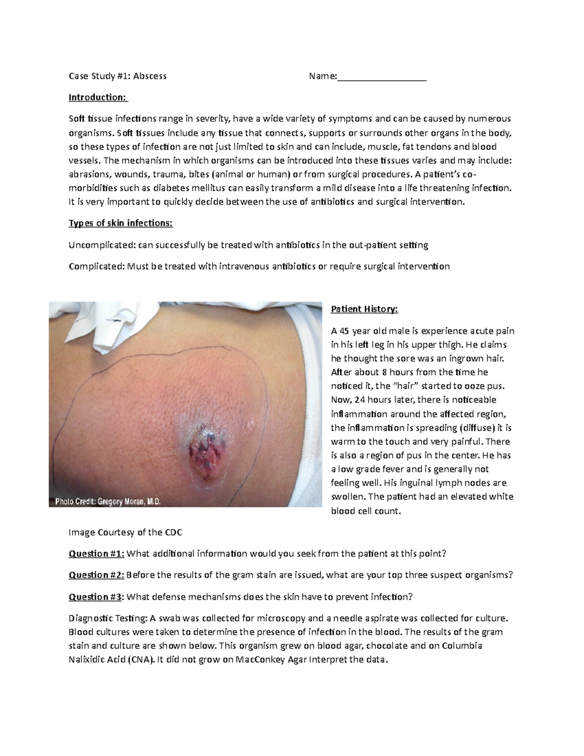 Case Study: Abscess in Microbiology - Diagnosis & Treatment (MB 101 ...