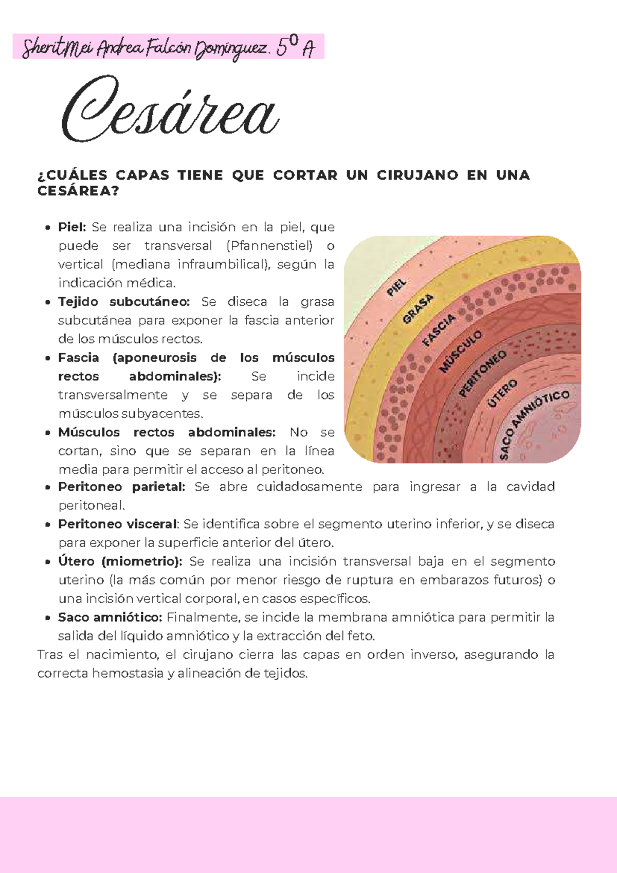 Cesárea - Procedimiento Quirúrgico en 5⁰ A CAPAS - Studocu