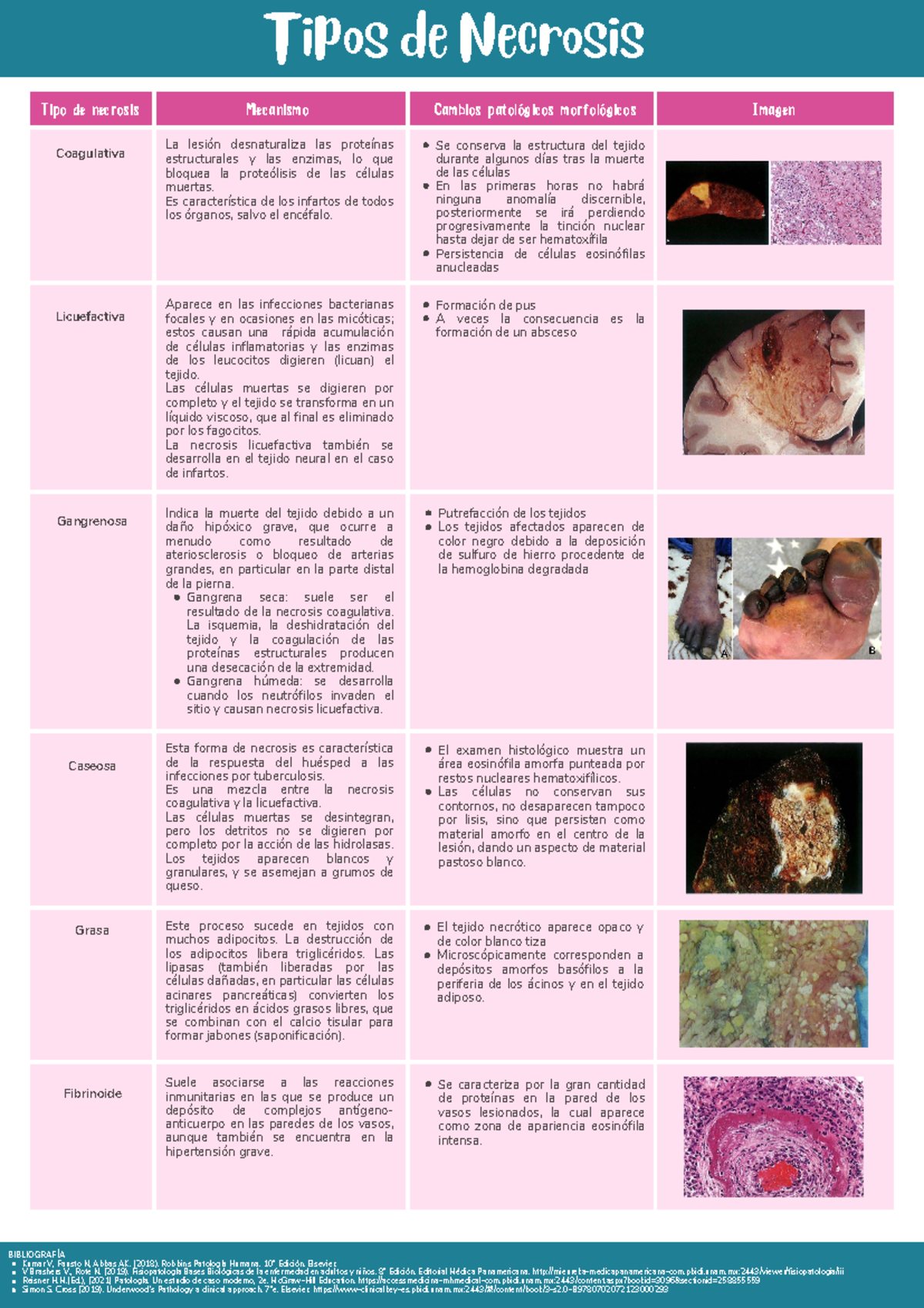Tipos De Necrosis - Tipos de Necrosis Tipo de necrosis Mecanismo ...