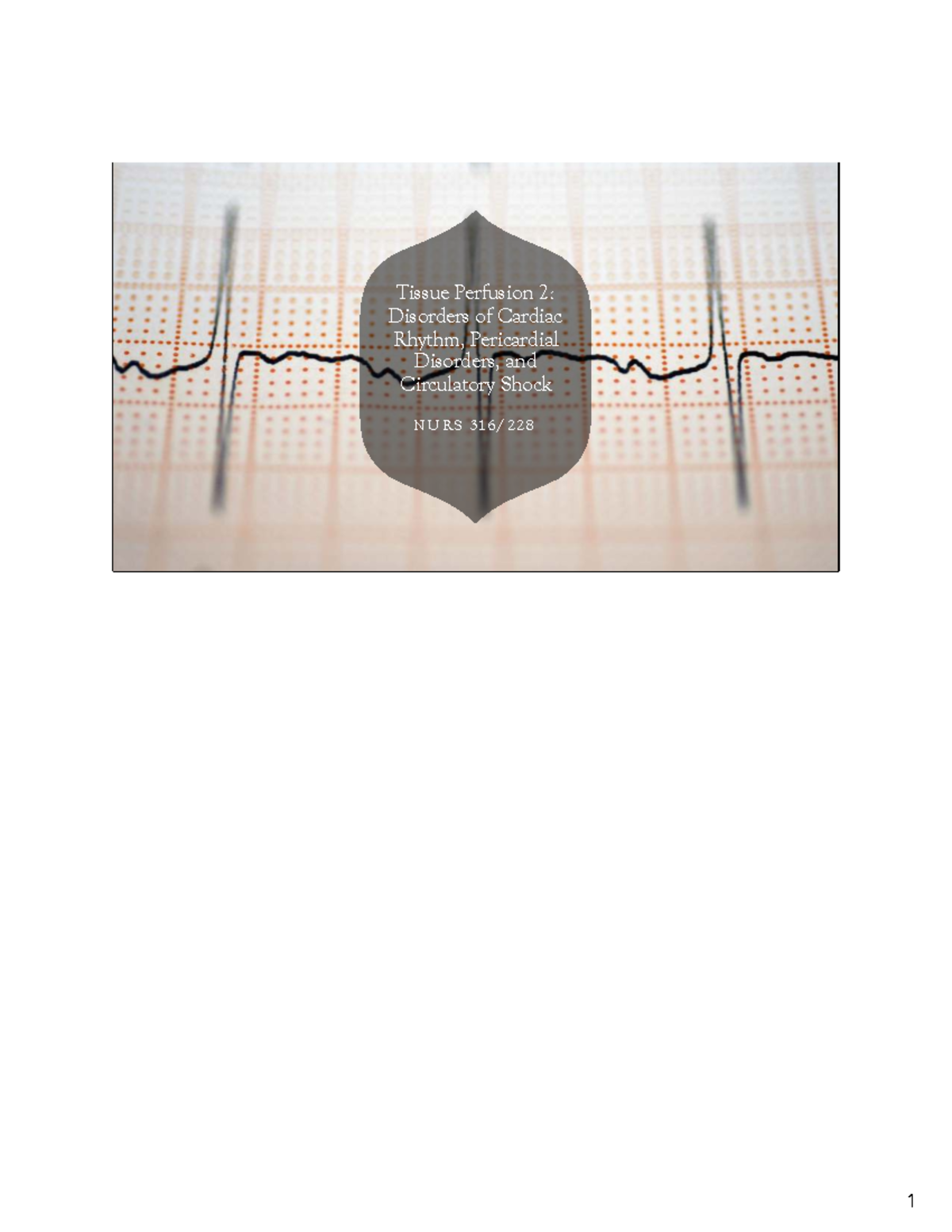 Tissue Perfusion 2: Cardiac Rhythm Disorders & Shock - NURS 316 - Studocu