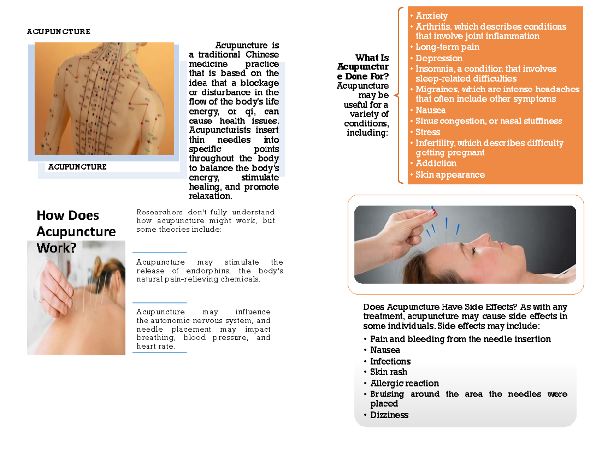 Alternative - this is a study notes - What Is Acupunctur e Done For ...