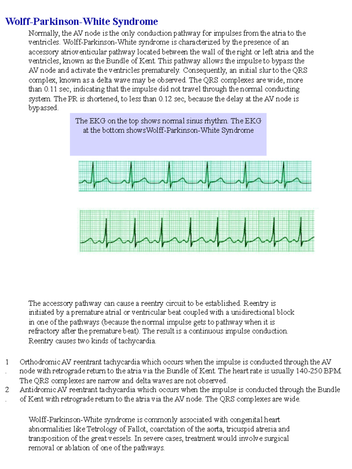 ECG reading materials with direct example for practice - The EKG on the ...