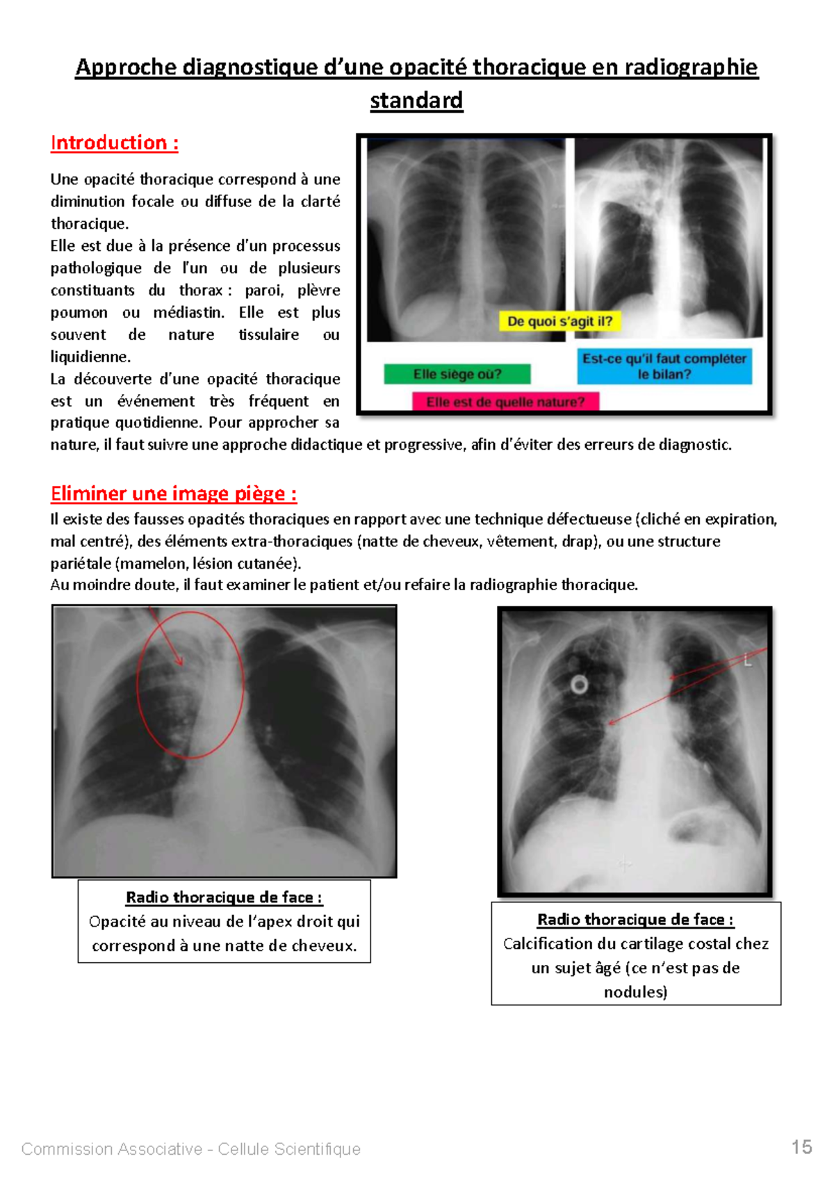 Approche diagnostique d'une opacité thoracique - TD en radiographie ...