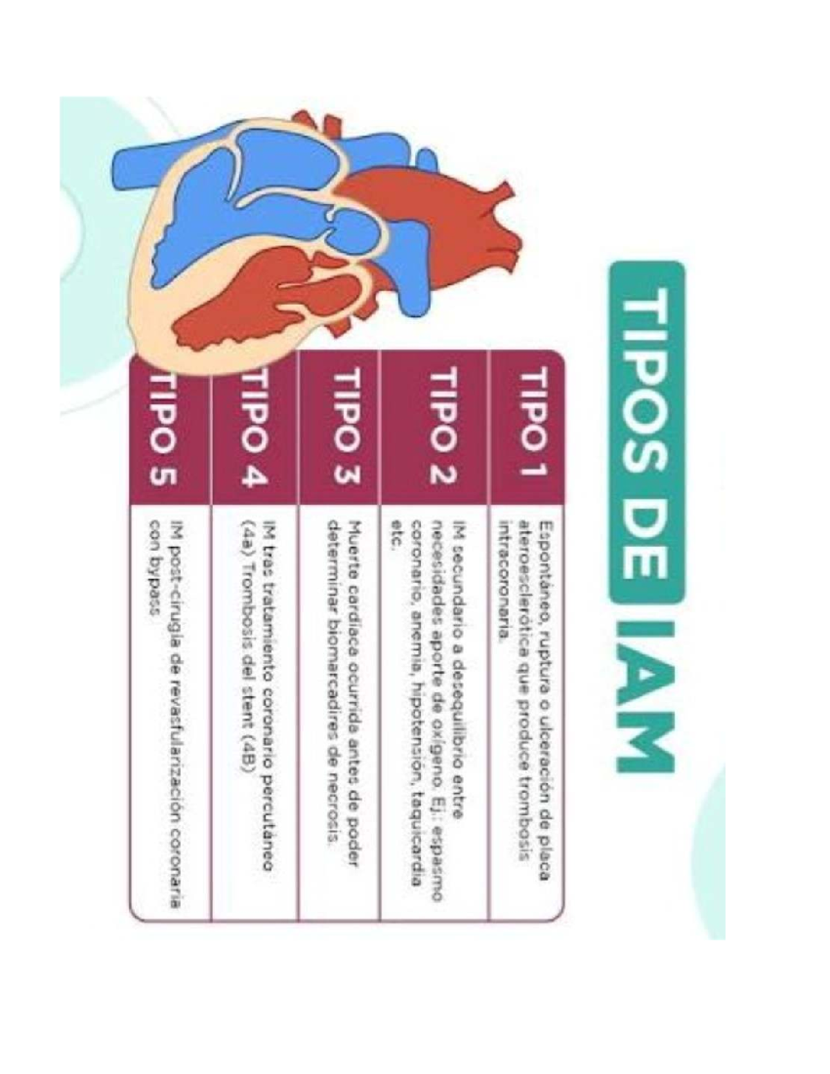 Infarto Agudo de Miocardio: Tipos y Diagnóstico (TIPO 1-5) - Studocu