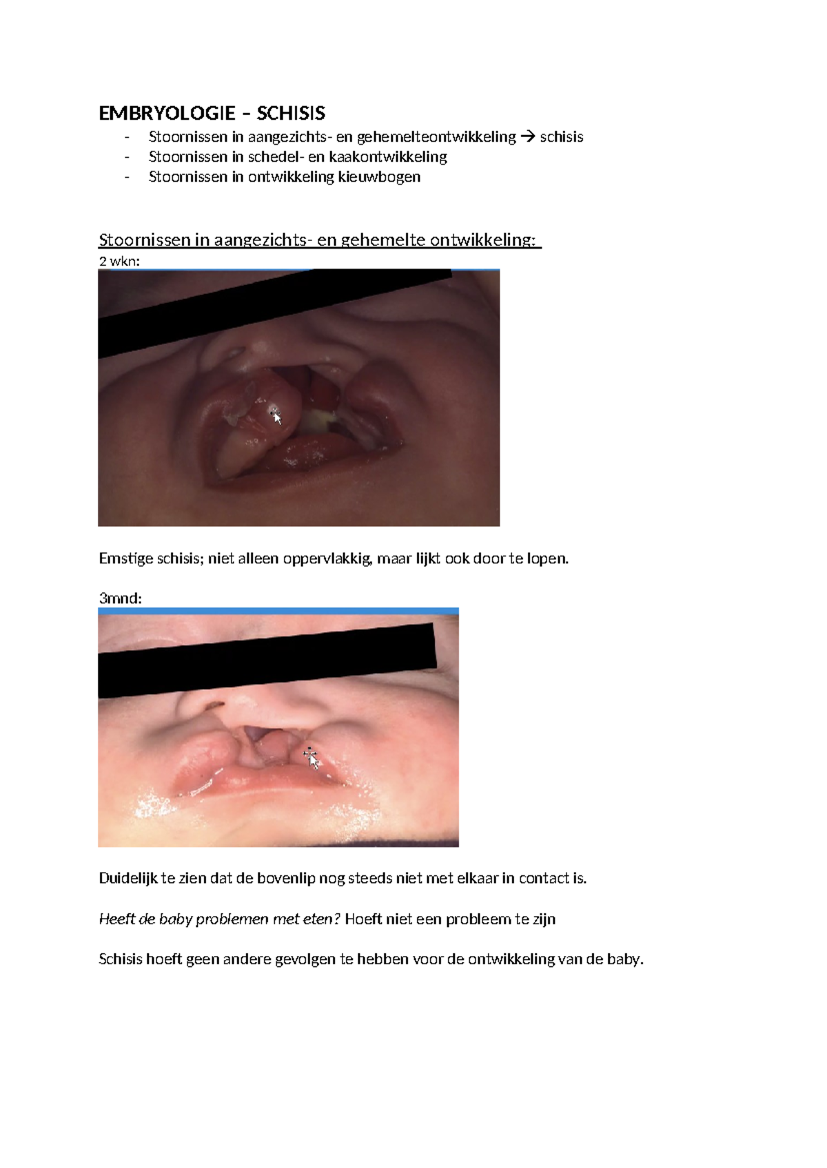 Embryologie Schisis: Ontwikkeling, Stoornissen en Behandelingen ...