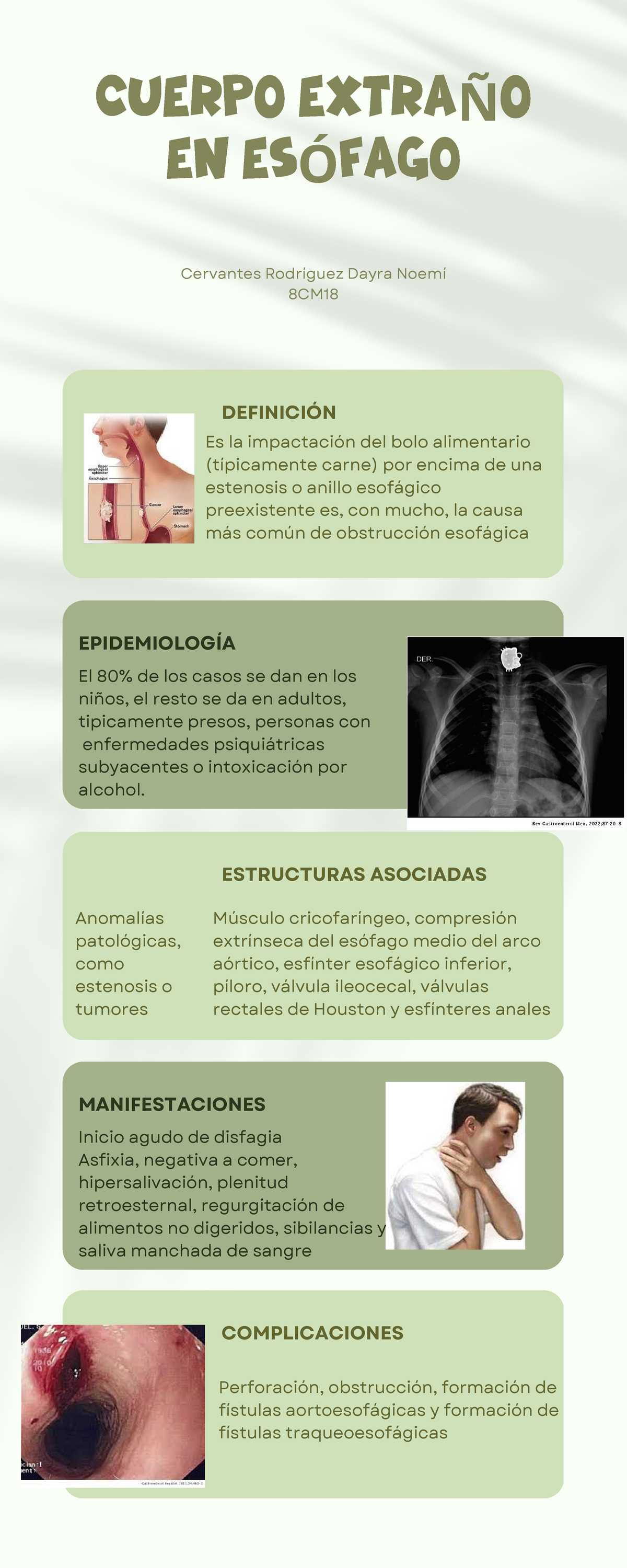 Cuerpo Extraño EN Esofago - CUERPO EXTRAÑO EN ESÓFAGO Cervantes ...