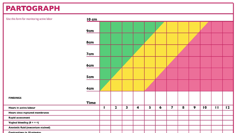 Partograph Monitoring for Active Labor: Key Findings and Assessments ...